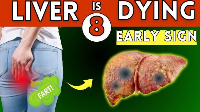 Is Your LIVER Crying for Help With These 8 Signs? | Healthcare | Before ...