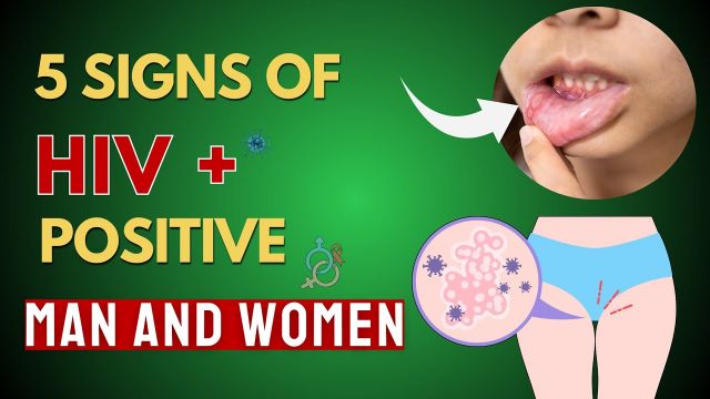 **"⚠️ WARNING SIGNS: 5 Key Symptoms of HIV You Should NEVER Ignore (For ...